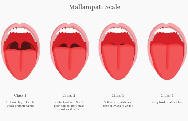 Sleep Apnea | Dr. Edward C. Yates